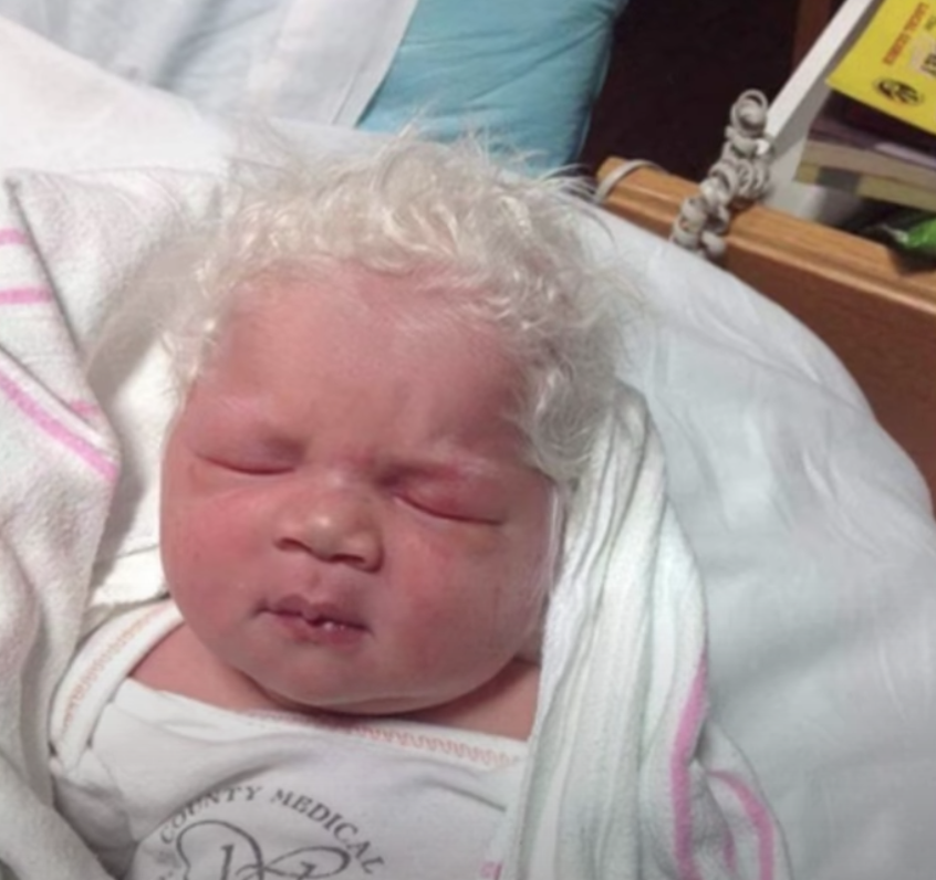 Parents don’t know what to think when baby is born with snow white hair