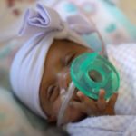 World’s tiniest preemie comes home at 8.6 ounces and beats all the odds