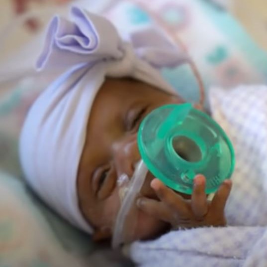 World’s tiniest preemie comes home at 8.6 ounces and beats all the odds