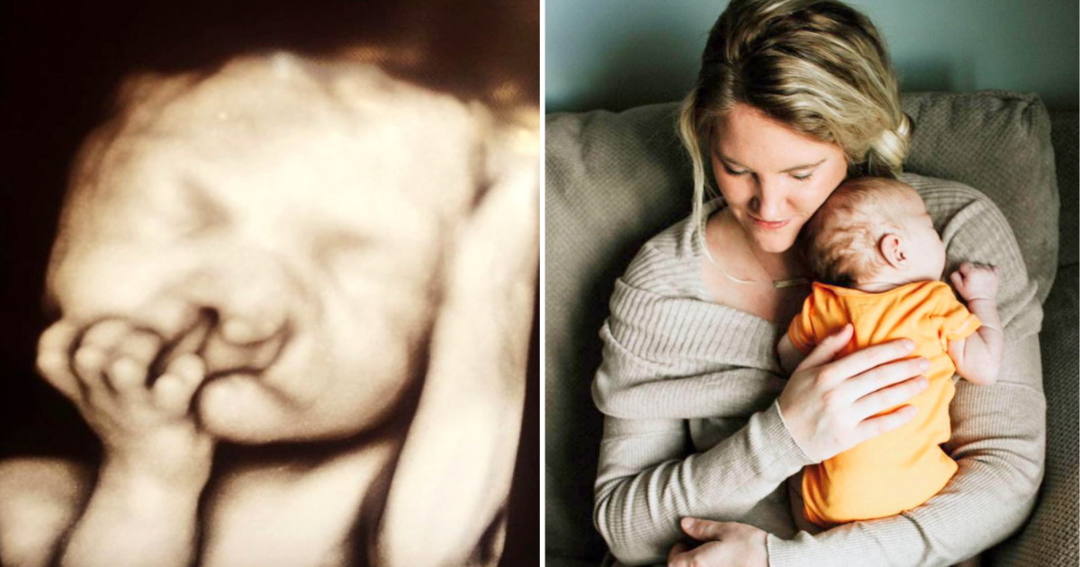 Parents who wouldn’t abort “deformed” baby share pictures of him today
