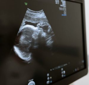 Newborn saves father’s life on day she’s born