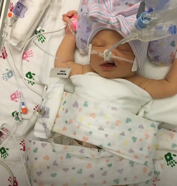 Little girl with heart surgery scar down her chest no longer alone ...