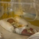 Parents of record-breaking nonuplets give a glimpse into hectic life ...