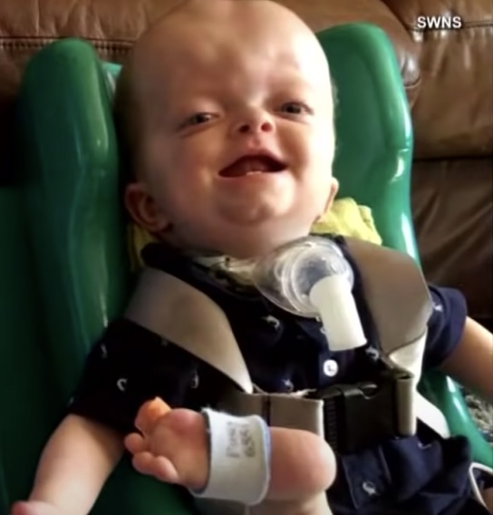 Twins with rare disorder rejected by parents so nurse goes above and beyond