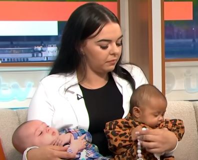 Mom gives birth to twins then notices one baby starts turning darker