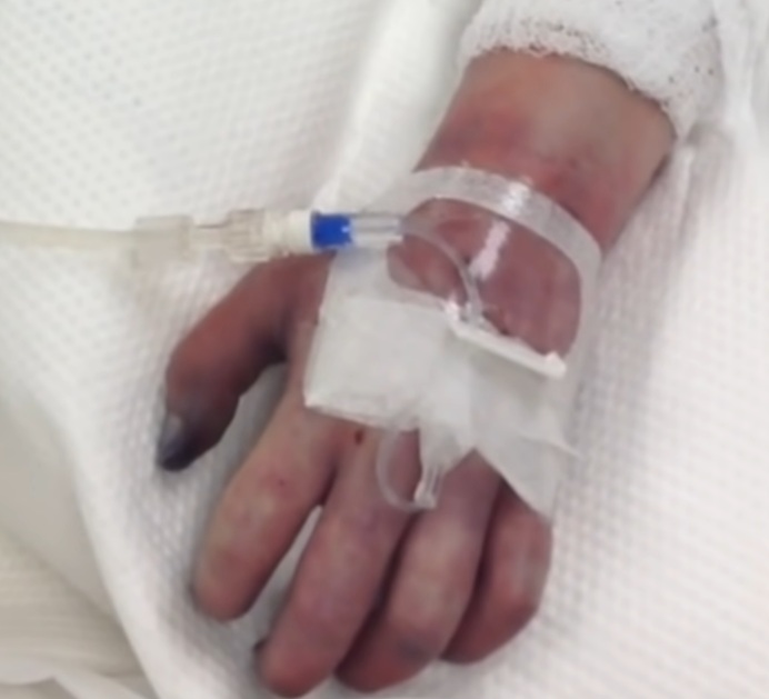 Little girl that lost her arms and legs following accident says she ...