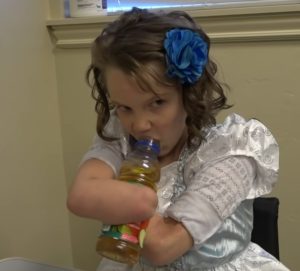 Little girl that lost her arms and legs following accident says she ...