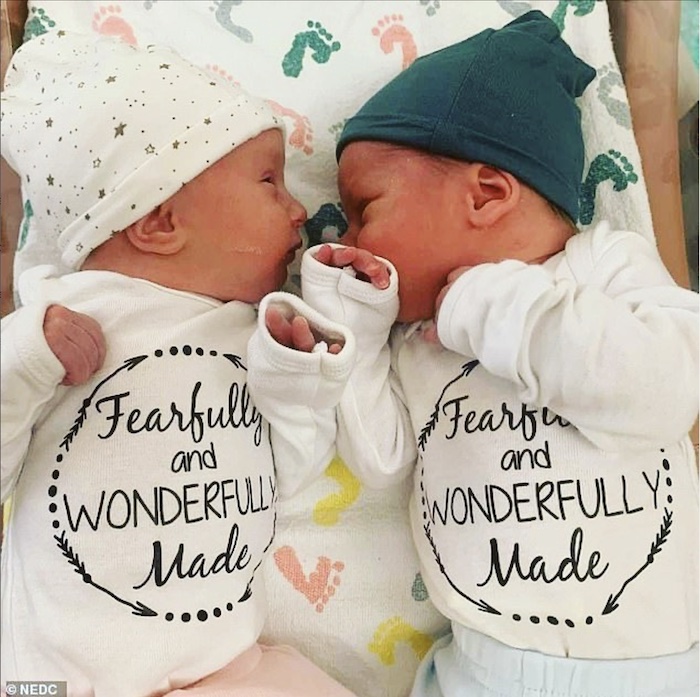 Couple welcome twins from 30 year old embryos shattering previous record